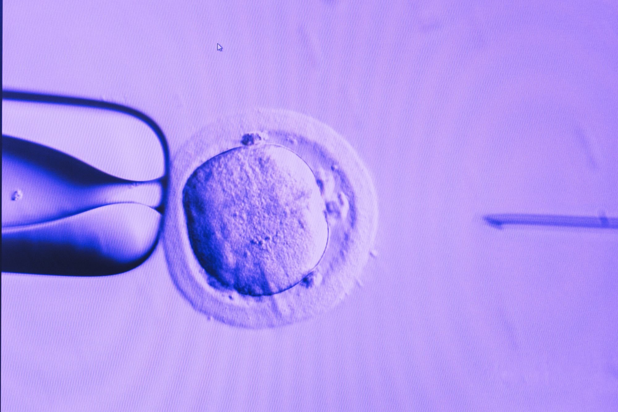 Preserving your fertility to secure future family life